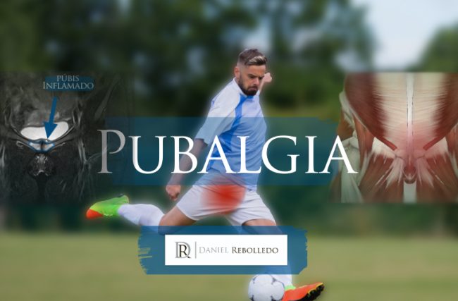 Pubalgia tem cura? Tudo sobre os Sintomas e Tratamento (2020) | Blog ...